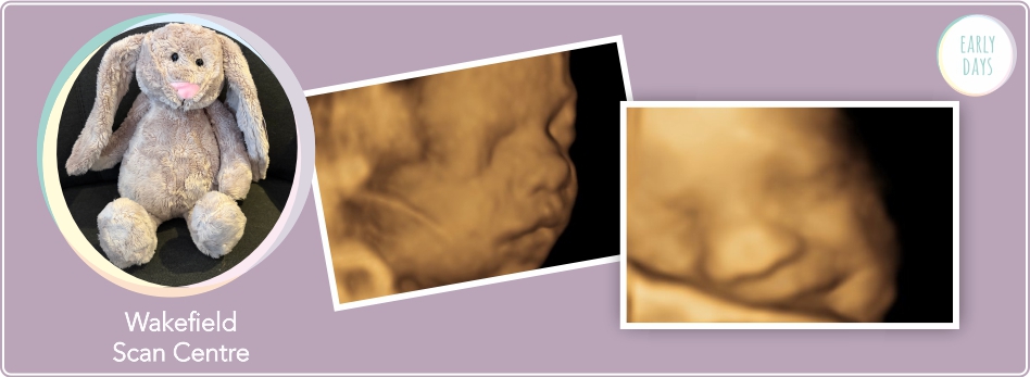 3D / 4D - Early Days Baby Scan Ltd, 4 Cheapside, Wakefield, West Yorkshire