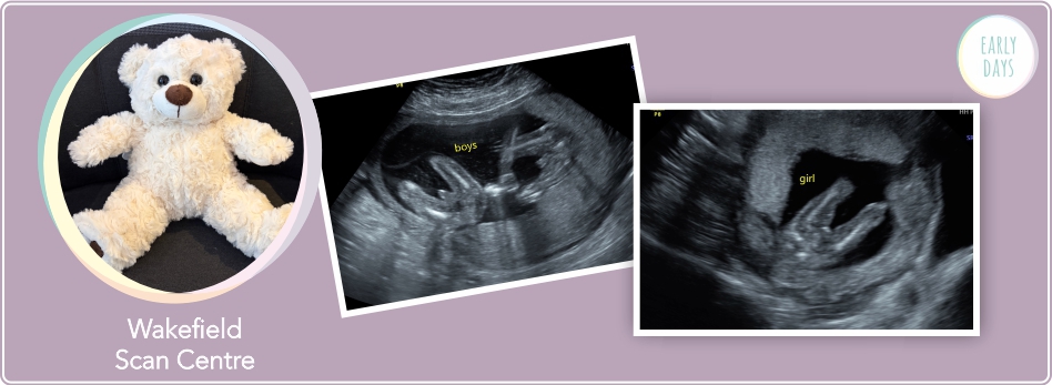 Gender - Early Days Baby Scan Ltd, 4 Cheapside, Wakefield, West Yorkshire